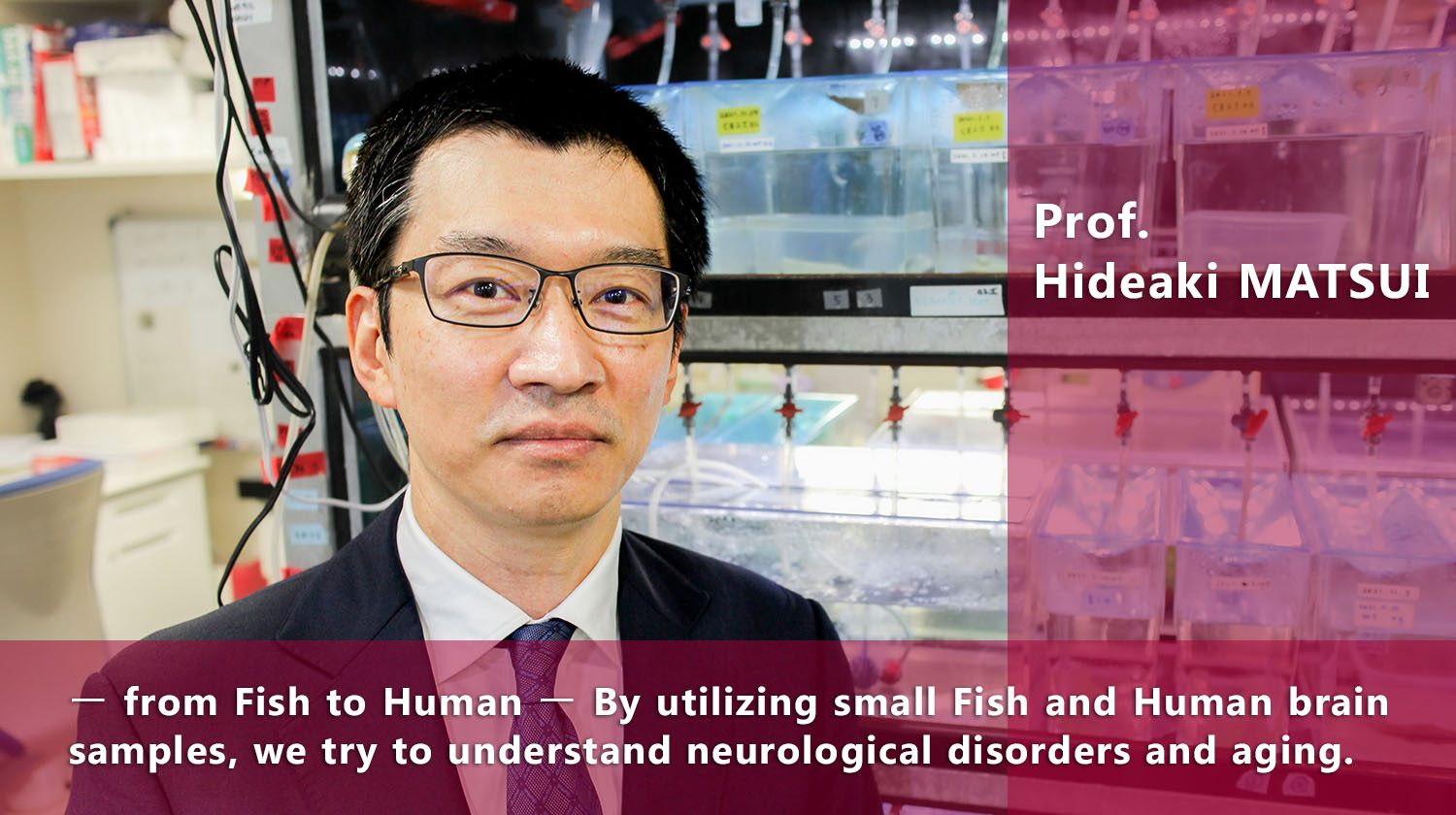 Neuroscience of Disease | BRI Departments | Brain Research Institute, Niigata University