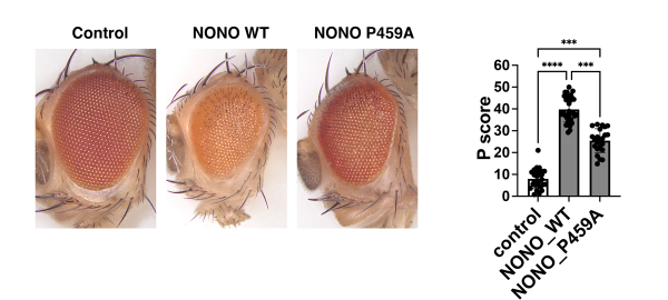 A novel NONO variant that causes developmental delay and cardiac ...
