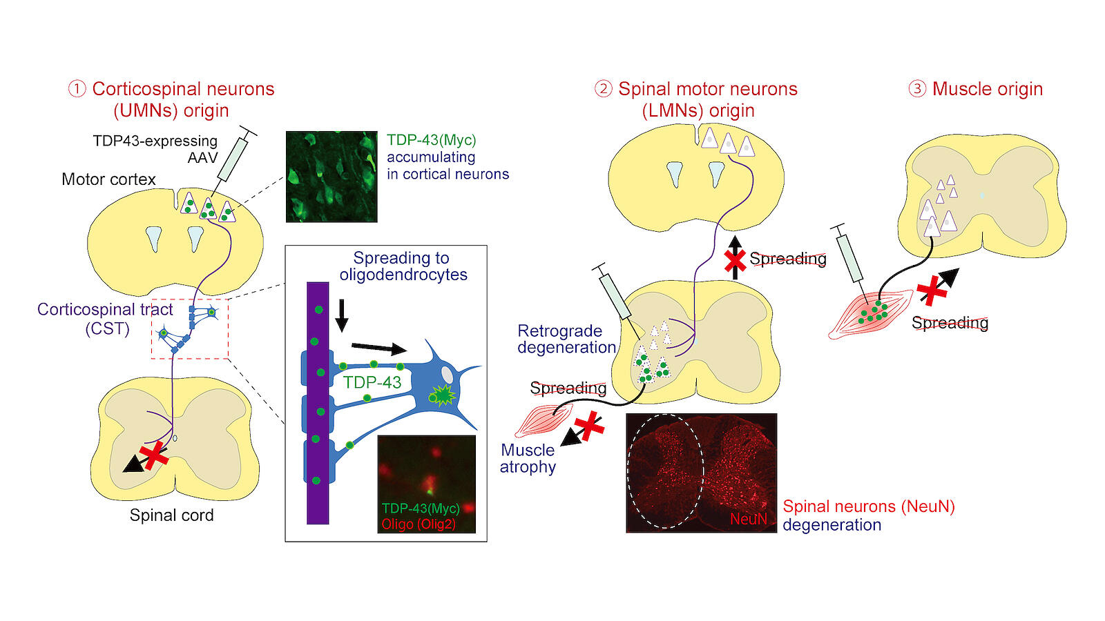 New Insights into the Protein-Mediated Motor Neuron Loss in Amyotrophic Lateral Sclerosis ...